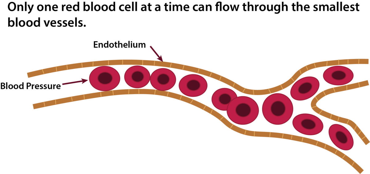 Therapeutic Plasma Exchange: An Oil Change for Your Body? – Scleroderma ...